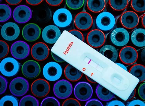 Health Unit Recommends Routine Testing For Syphilis Hometown News