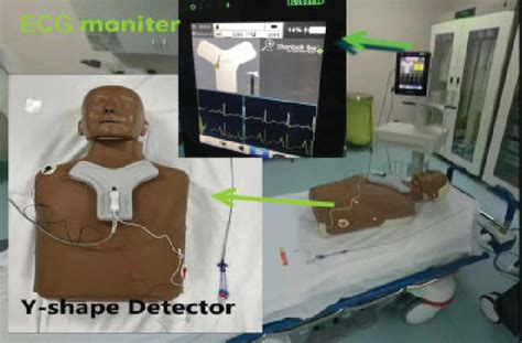 Electrocardiogram ECG Guided Peripherally Inserted Central Catheter Download Scientific
