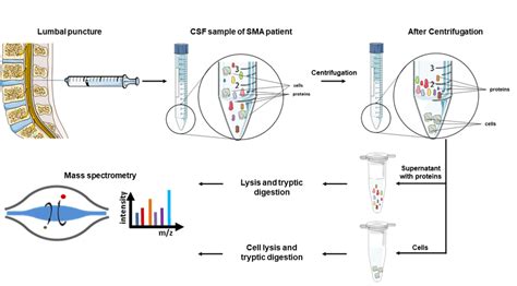 Potential Workflow For A Mass Spectrometric Analysis Of Csf Samples Download Scientific Diagram
