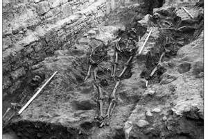 14th Century Tooth Reveals Grim Fate Of Edinburgh Teen Killed By The