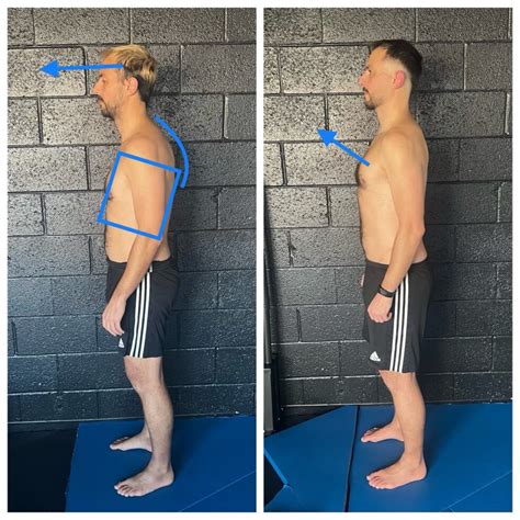 Scoliosis Treatment Without Surgery Move As A Human Michigan