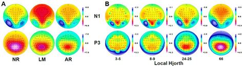 Issues And Considerations For Using The Scalp Surface Laplacian In Eegerp Research A Tutorial