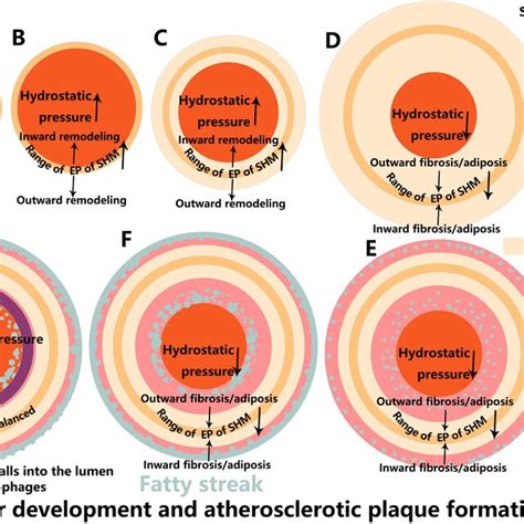 Formation Of Myofibroblast And Macrophage Derived Foam Cells Download Scientific Diagram