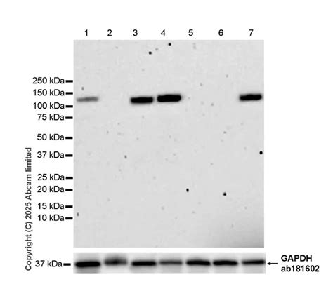 Anti N Terminal Lphn2 Antibody [epr29557 9] Ab324484 Abcam