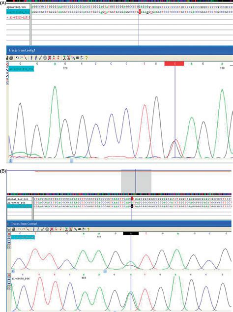 Nucleotide Sequence Analysis Of The Substitutions In Heterozygous Hba1 Download Scientific