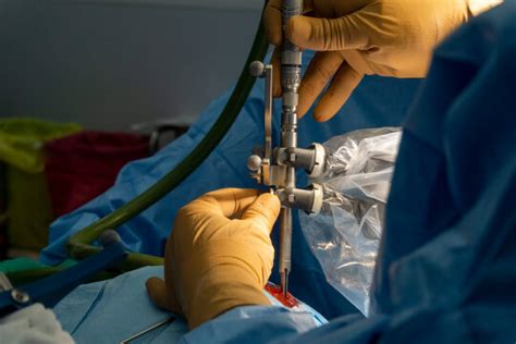 Craniotomy Imagens Procure 334 Fotos Vetores E Vídeos Adobe Stock