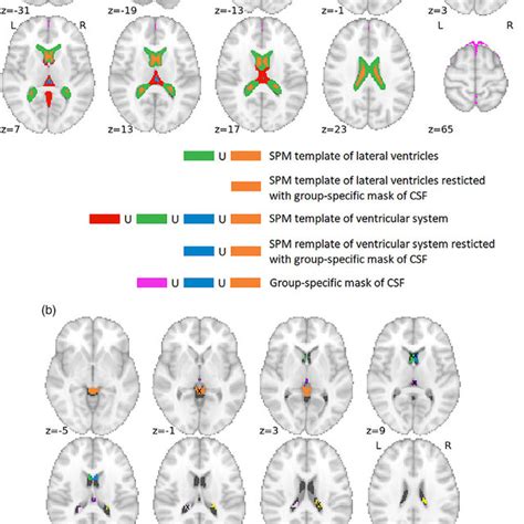 Schematic Pipeline Depiction Of Fmri Data Preprocessing And Computation