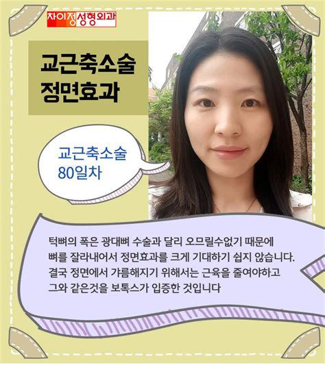 차이정성형외과 근육만 없애오던 기존 교근축소술 방식에 신경을 차단하는 효과까지 플러스 이중으로 Facebook