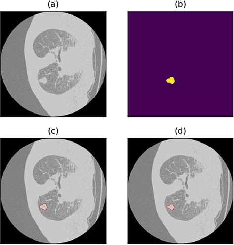 Figure 4 From Lung Nodule Segmentation Via Semi Residual Multi