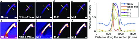 A Qualitative Comparison For Mitochondria Where Artefact Suppression Download Scientific