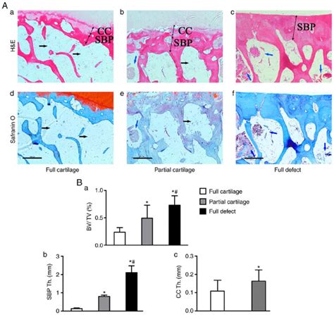 Alternation Of The Microstructure In Subchondral Bone From Human Knee