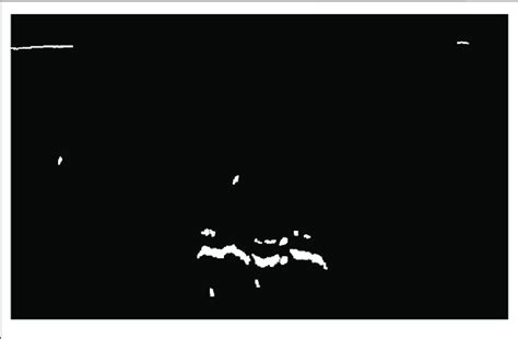Binary Image After Connected Region Area Check Processing Download Scientific Diagram