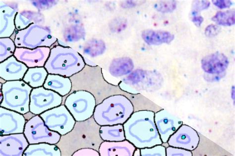 RNA Scope Probe Design