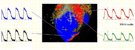 Action Potential Waveforms For Four Sample Pixel Locations Of The