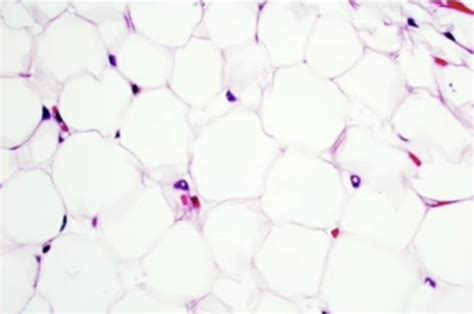 ADIPOSE TISSUE Flashcards Quizlet