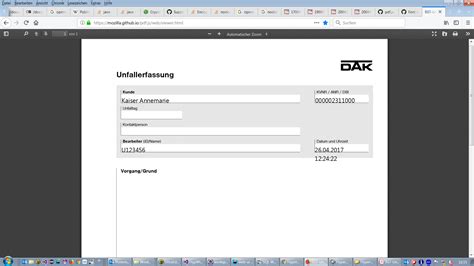 Text Not Shown Properly Possibly A Font Problem · Issue 11151