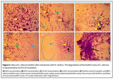 Moringa Oleifera Extracts Inhibit And Disrupt Microbial Biofilms R