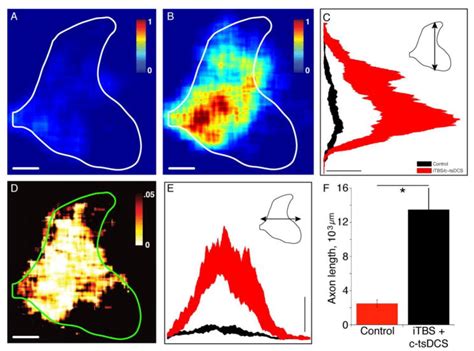 Combined Motor Cortex And Spinal Cord Neuromodulation Promotes Corticospinal System Functional