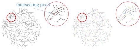 skeleton segmentation process from left to right the skeleton map