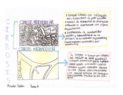 Dibujos De Anatomia Patologica Cirrosis Docsity