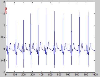 Matlab Plot Graph Only Show Threshold Stack Overflow