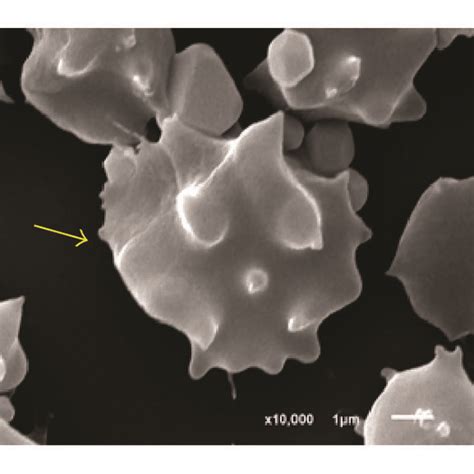 Scanning Electron Micrograph Of Dysmorphic Erythrocyte Induced By Download Scientific Diagram