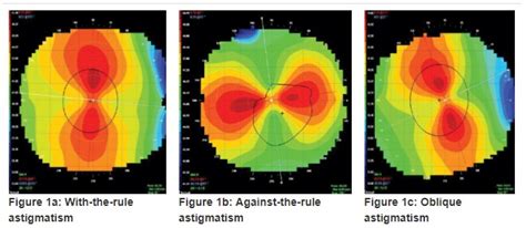 Astigmatism Eyecing On The Cake