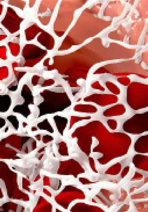 Prothrombin Complex Concentrate A General Antidote For Oral