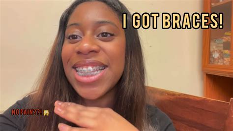 I Got Braces Vlog Youtube