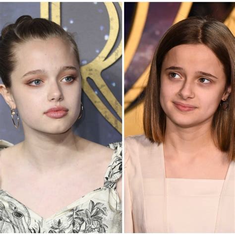 Sindrome De Down Dos Gemeos Jolie Pitt