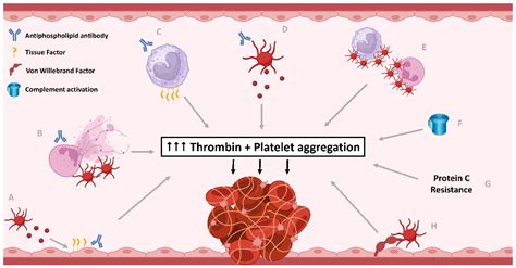 Platelets And Thrombotic Antiphospholipid Syndrome