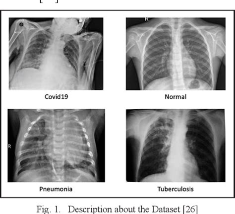 Figure From Classification Of Lung Diseases Using Deep Learning Techniques A Comparative
