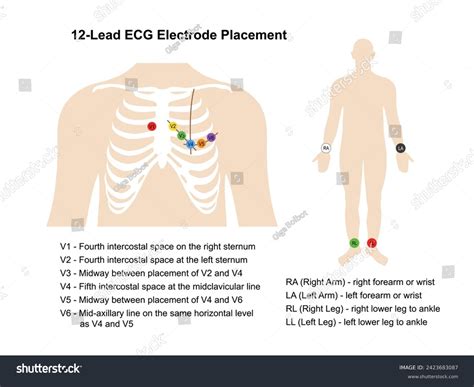 6 Imágenes Fotos De Stock Objetos En 3d Y Vectores Sobre 12 Lead Ecg