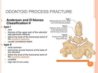 Cervical Spine Fracture Radiology Classification And Management Pptx