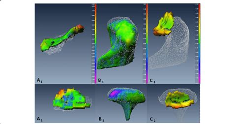 Tmj 3d Reconstructed Models Representative Of Tmj From An Mri Cbct Download Scientific Diagram