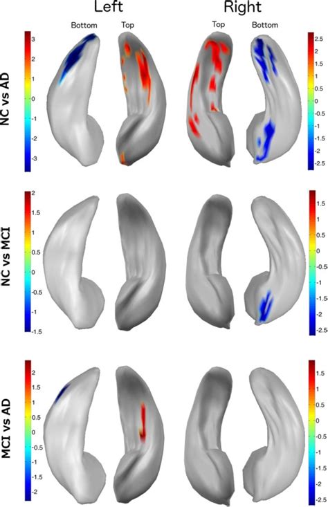 T Value Color Map Is Reported Positive And Negative T Values Represent Download Scientific