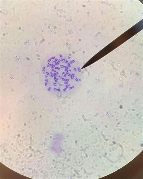 Cromosomas Humanos Bajo El Microscopio Farmacias La Vida Facebook