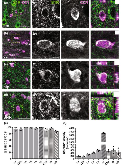 Specific Detection And Deletion Of The Sigma‐1 Receptor Widely