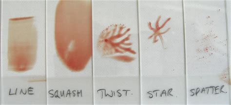 WEEK Approach To The Cytology Smear Flashcards Quizlet