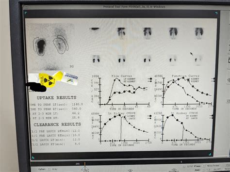 Renogram Protocol Rradiology