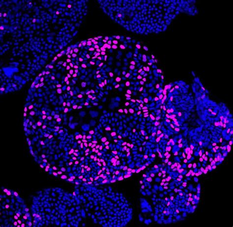 🔬细胞增殖检测法：edu染色全攻略