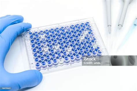 과학자는 96 잘 마이크로 플레이트와 파이펫에 의해 Elisa 면역 분석을 테스트 우물에 대한 스톡 사진 및 기타 이미지
