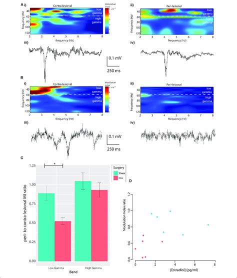 Modulation Index A Modulation Index From Contra Lesional Ai And