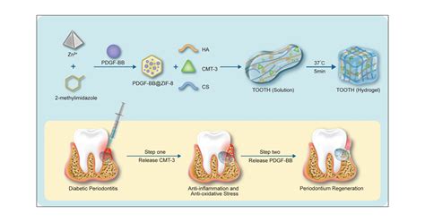 Convertible Hydrogel Injection Sequentially Regulates Diabetic