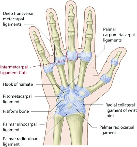 Fifth Metacarpal Definition Location Anatomy Diagram