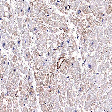 Actin Recombinant Rabbit Mab Sdt R156 Starter 优宁维 Univ 商城