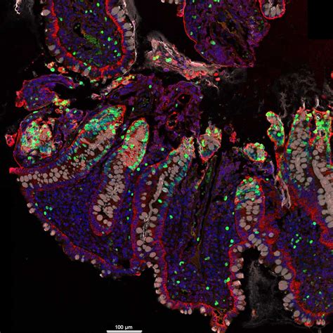 Immuno Fluorescence Staining Of Human Ffpe Formalin Fixed Paraffin Embedded Gut Mucosal Biopsy
