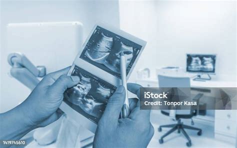 초음파 복부 보고서를 들고 있는 의사가 병원의 초음파실 환자를 지켜보고 있다 의료 이미지 개념 Stem 주제에 대한 스톡 사진