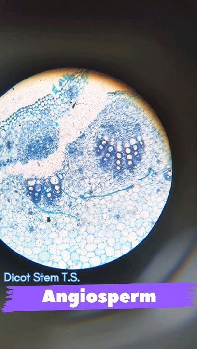 Dicot Stem Ts Angiosperm Pharmacyshorts Education Humananatomy
