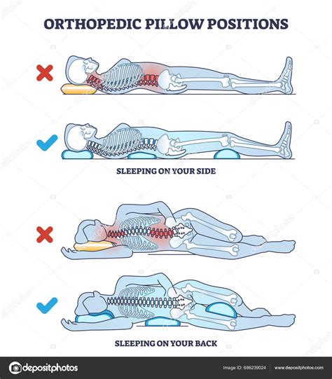 Orthopedic Pillow Positions Sleeping Side Back Outline Diagram Labeled